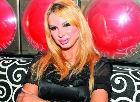 Marinela Nitu, inainte si dupa operatiile estetice (POZE)