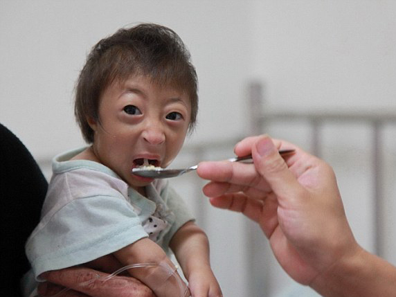 Cel mai mic copil din lume e o fetiță din China